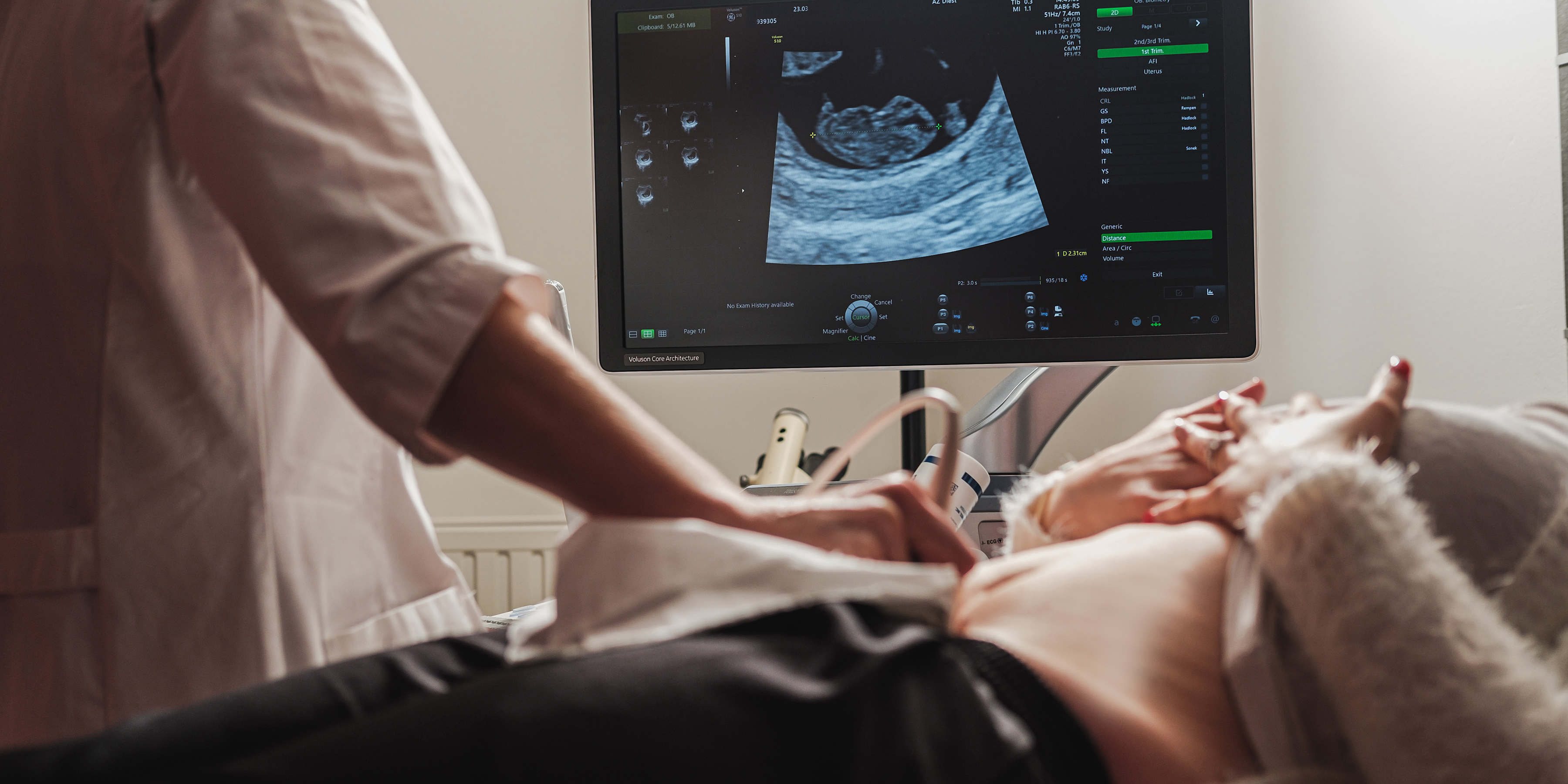 Algemene gynaecologie, verloskunde en echografie | AZ Diest